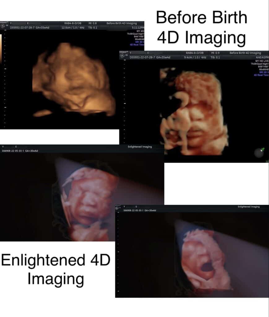 Enlightened 4D Imaging vs Before Birth Imaging (Blaine) - Enlightened ...