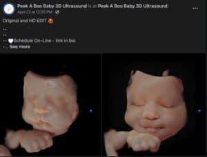 Unraveling the Mystery of Ultrasound Imaging: 2D, 4D, 5D, 8K, and HD ...